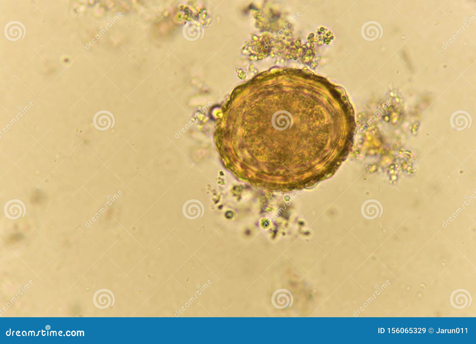 Egg of Ascaris Lumbricoides in Stool Stock Image - Image of micro ...