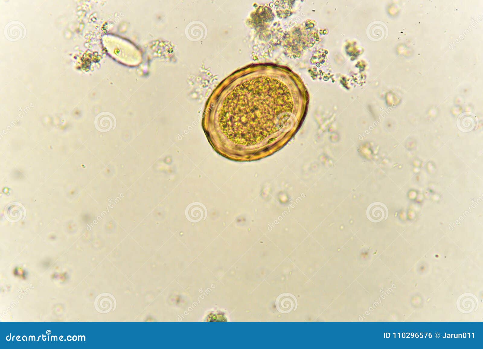Egg of Ascaris Lumbricoides in Stool Stock Photo - Image of disease ...