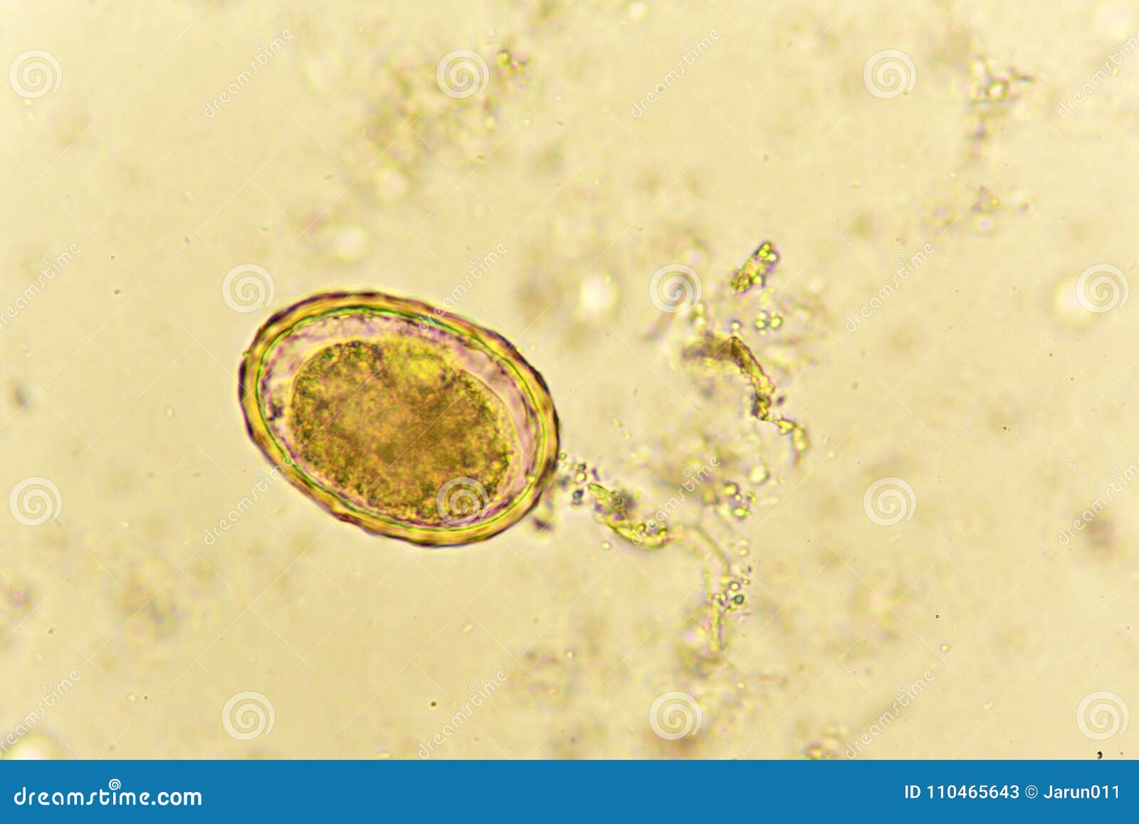 Egg of Ascaris Lumbricoides in Stool Stock Image - Image of ...