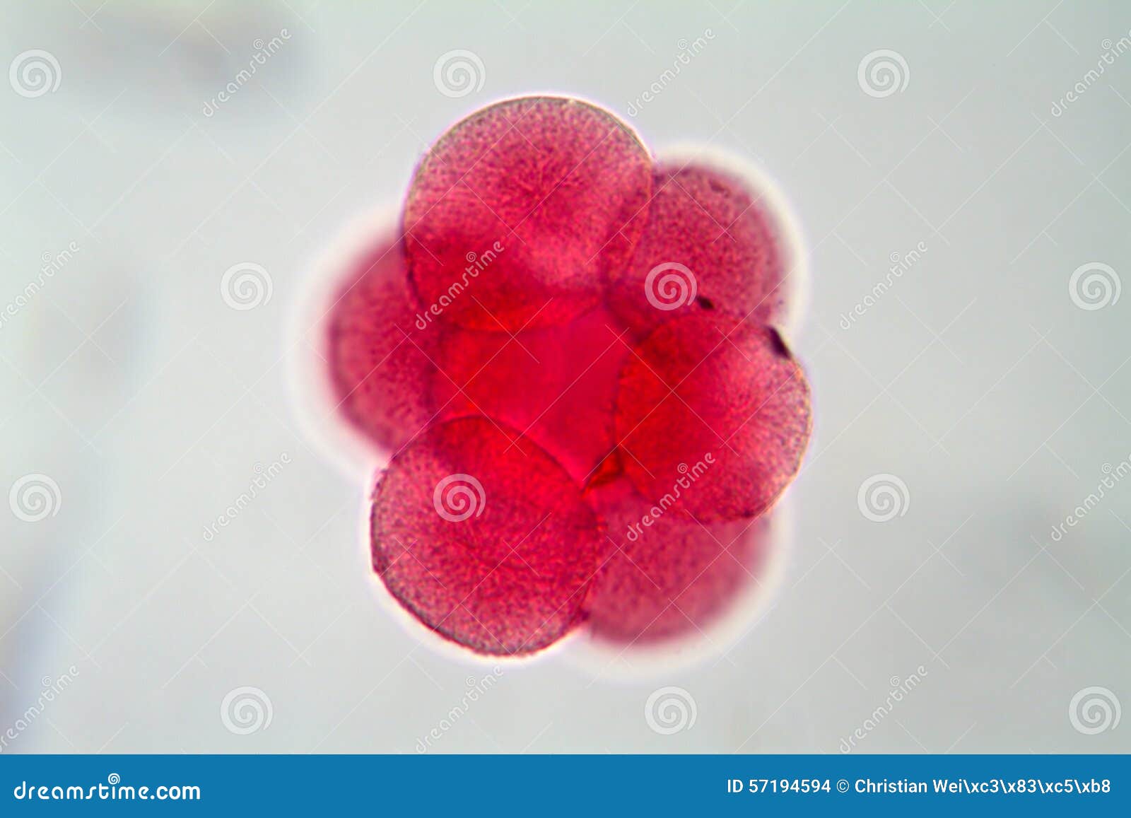Egg Cell Under the Microscope. Stock Photo - Image of infection ...