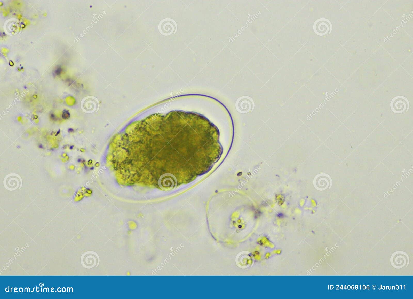Egg of Hookworm in Human Stool Stock Photo - Image of organism ...