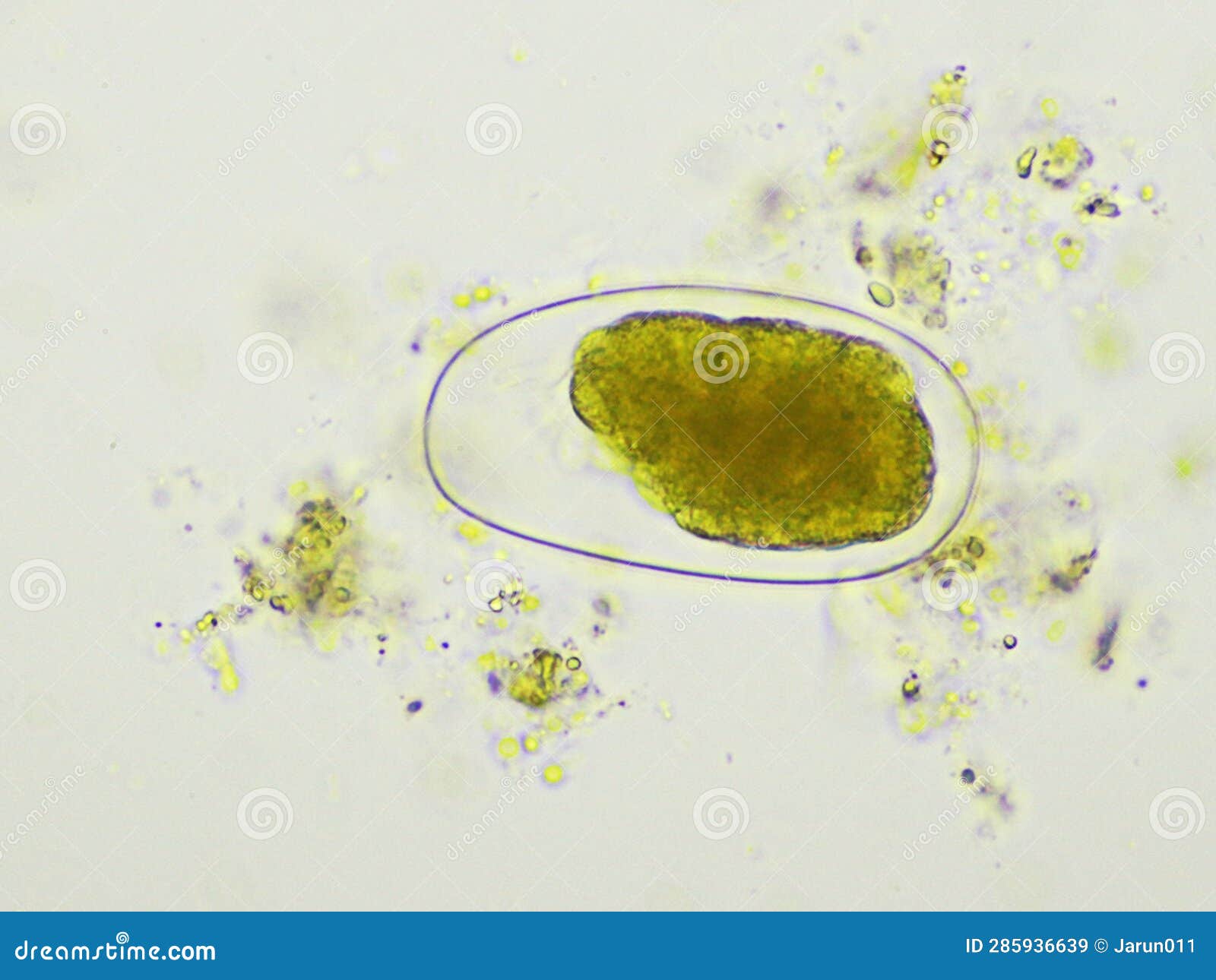 Hookworm Egg Human Parasite In Stool Examination Test Royalty-Free ...