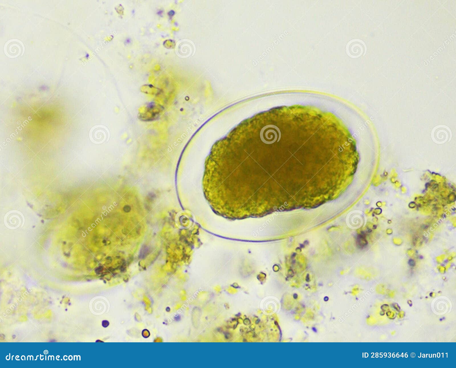 Egg of Hookworm in Human Stool Stock Photo - Image of test, patient ...