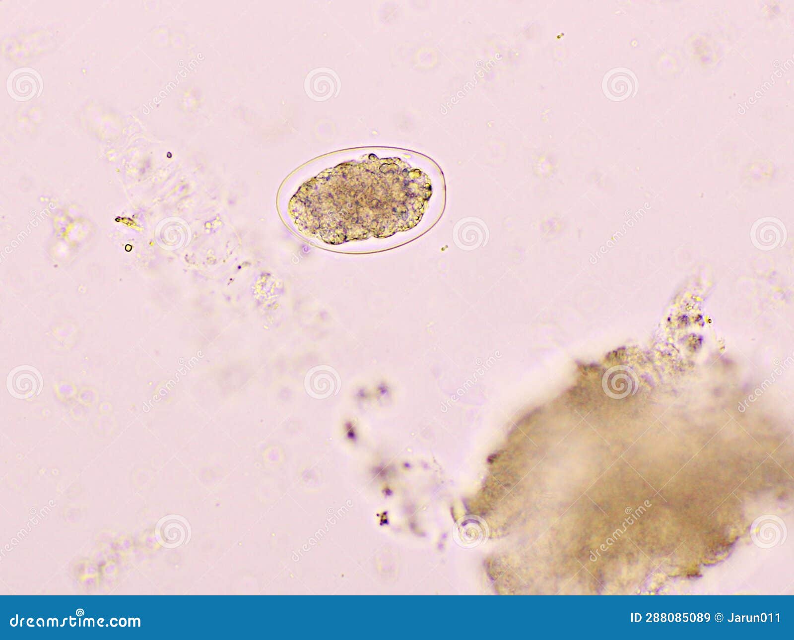 Egg of Hookworm in Human Stool Stock Image - Image of roundworm, microscope: 288085089