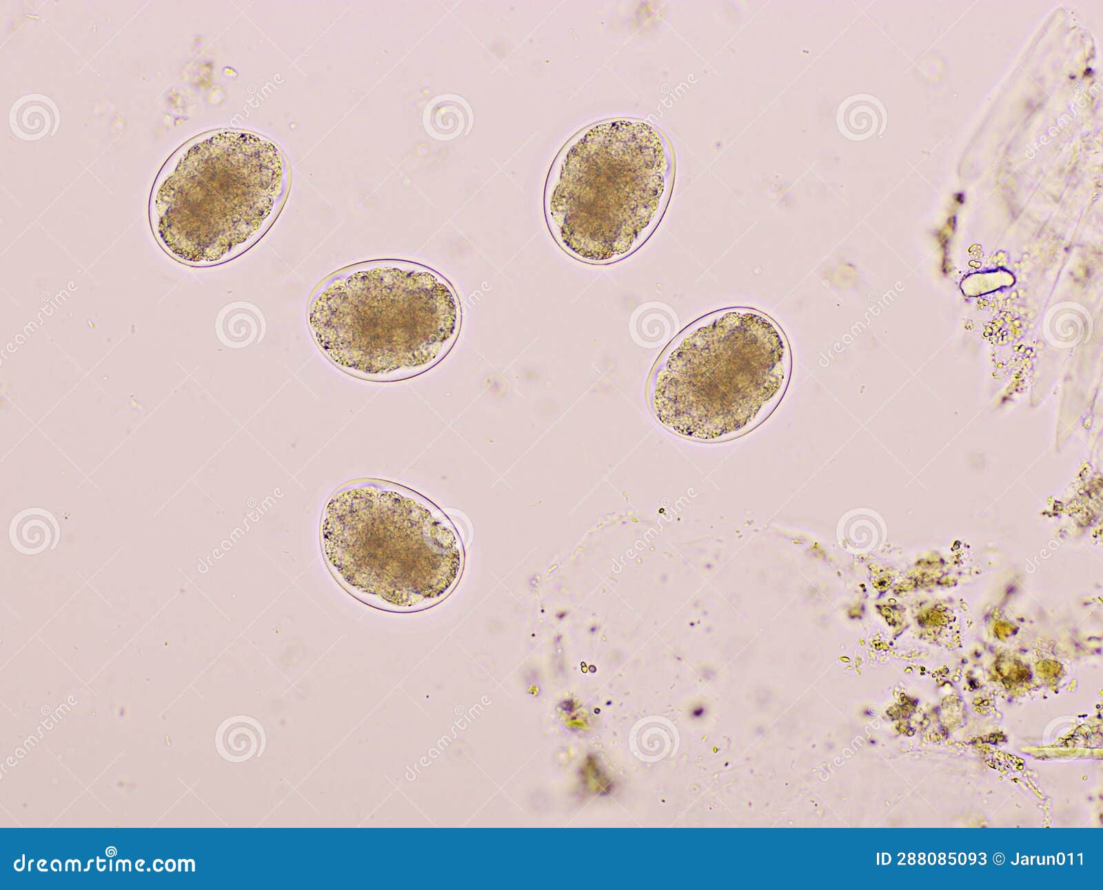 Egg of Hookworm in Human Stool Stock Image - Image of helminths ...