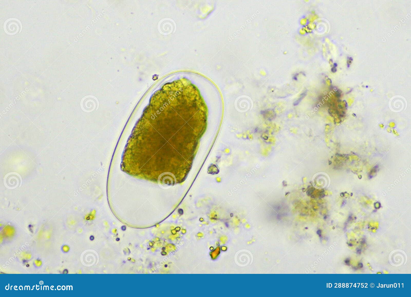 Egg of Hookworm in Human Stool Stock Photo - Image of worm, feces: 288874752