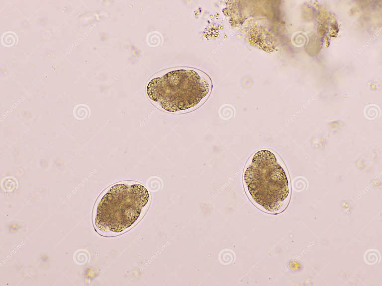 Egg of Hookworm in Human Stool Stock Photo - Image of fecal, scientific ...