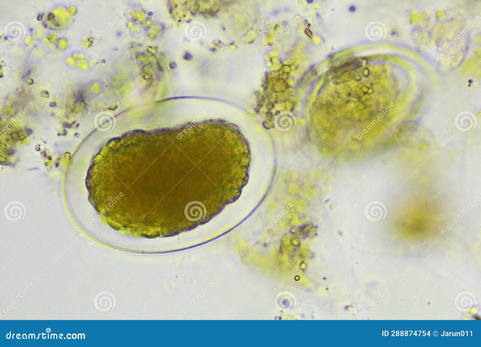 Egg of Hookworm in Human Stool Stock Photo - Image of patient, cestode: 288874754