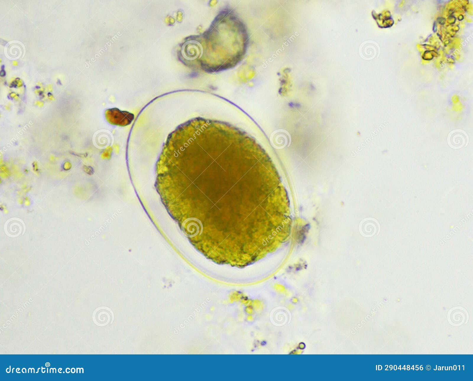 Egg of Hookworm in Human Stool Stock Photo - Image of experiment ...