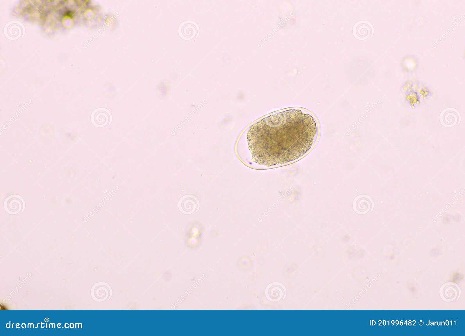 Hookworms In Human Stool