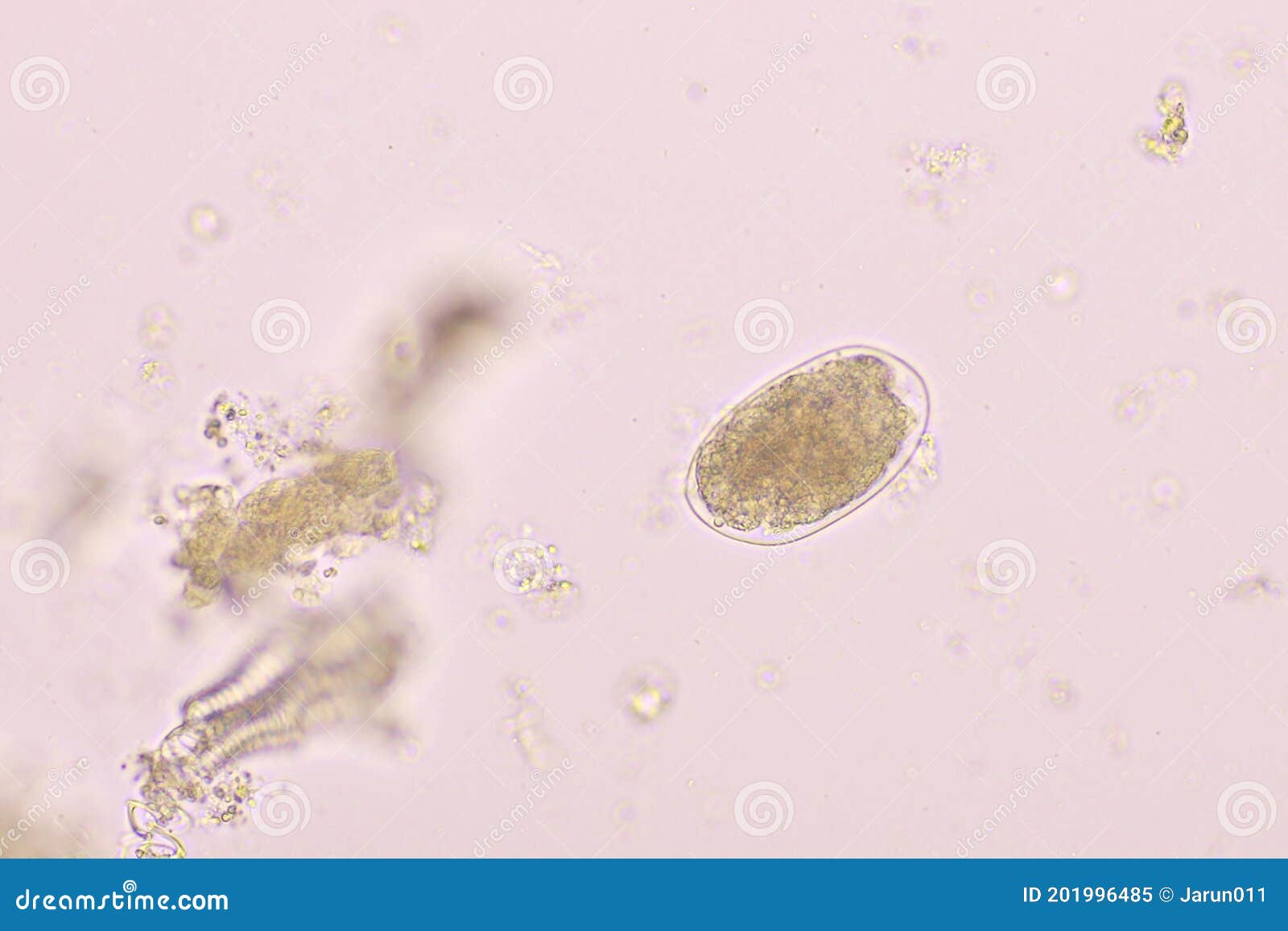 Hookworm In Stool Royalty-Free Stock Image | CartoonDealer.com #106455526