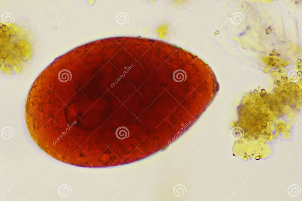 Egg of Intestinal Fluke in Human Stool Stock Image - Image of analyze ...