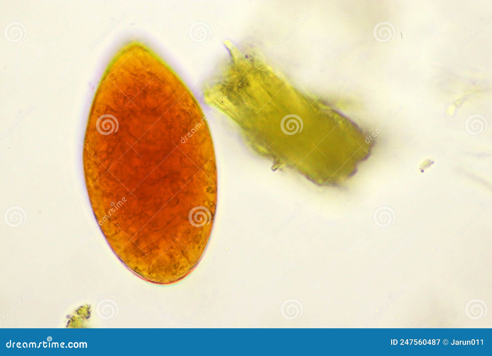 Egg of Intestinal Fluke in Human Stool Stock Image - Image of analyzing ...