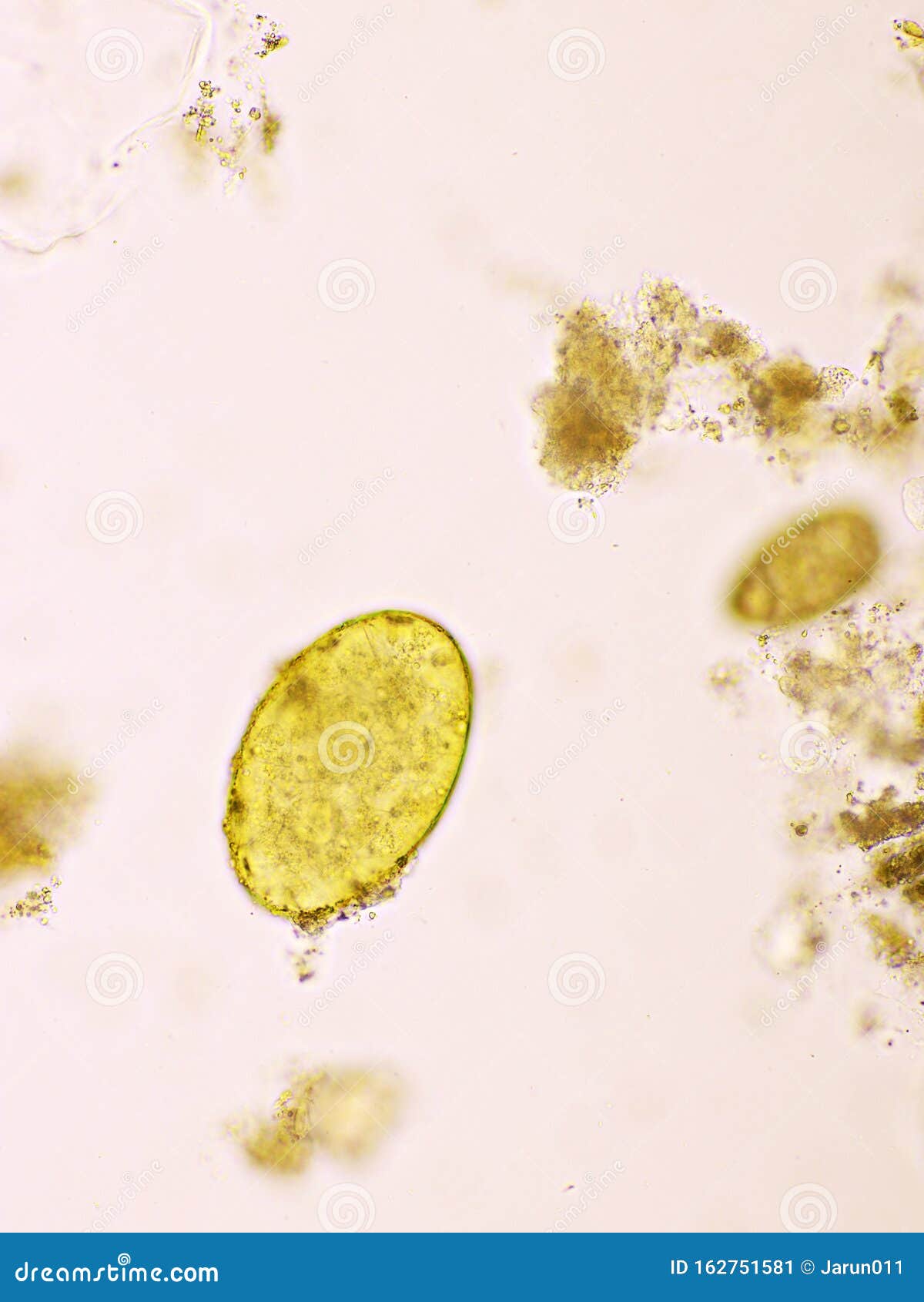 Egg of Intestinal Fluke in Human Stool Stock Image - Image of exam ...