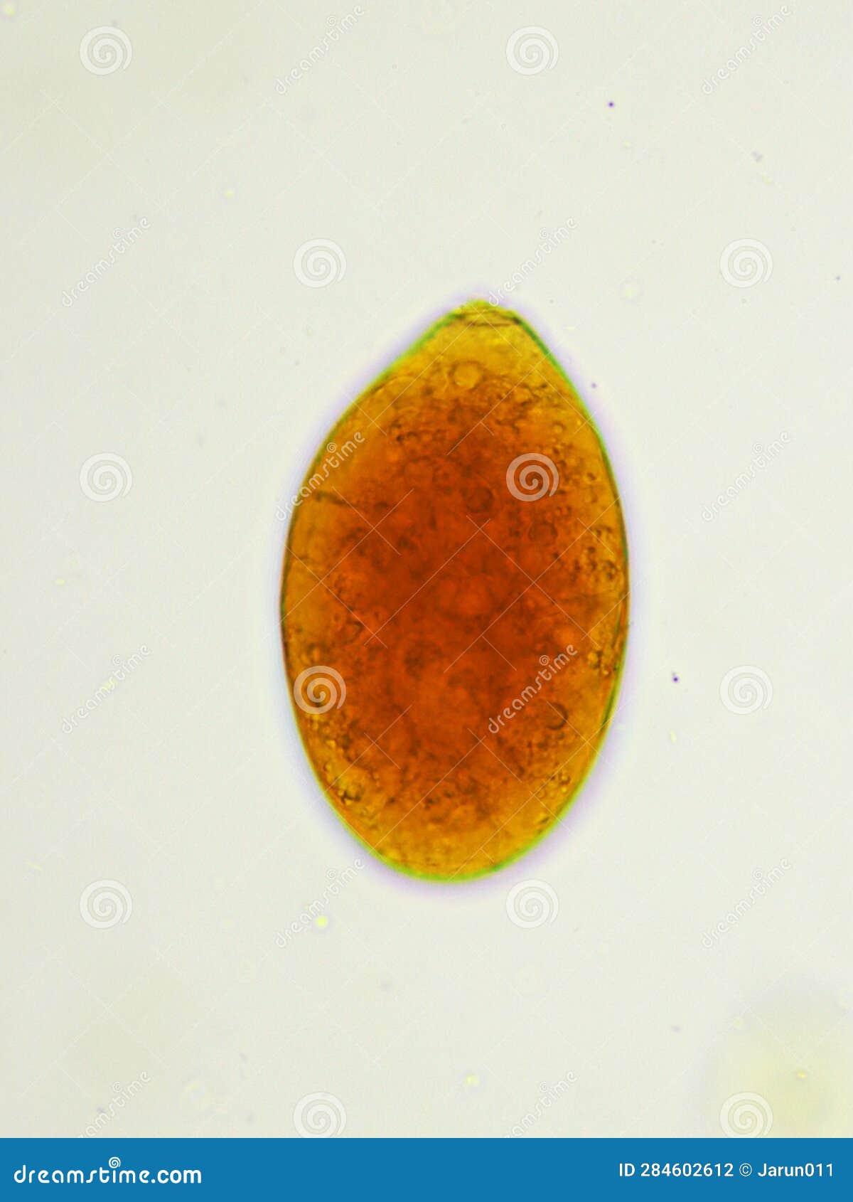 Egg of Intestinal Fluke in Human Stool Stock Photo - Image of ...