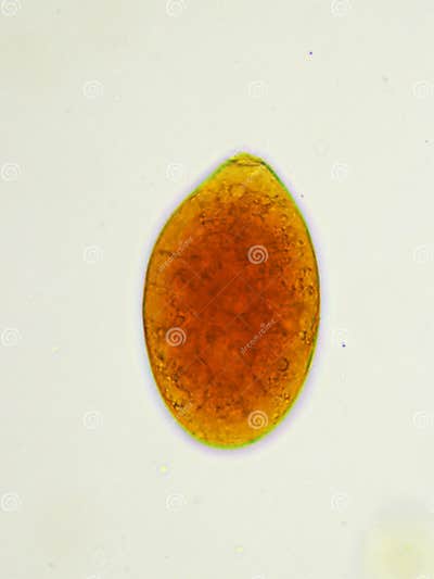 Egg of Intestinal Fluke in Human Stool Stock Photo - Image of ...