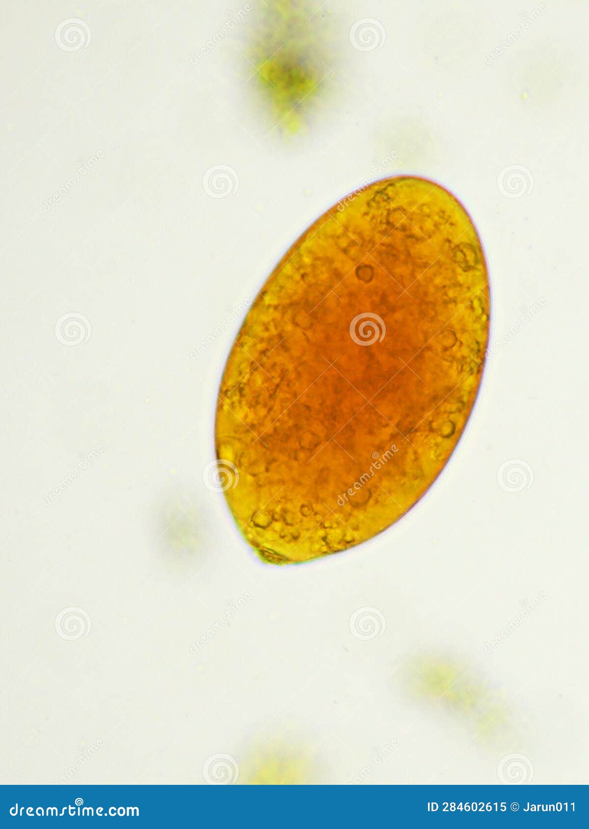 Egg of Intestinal Fluke in Human Stool Stock Image - Image of nematode ...