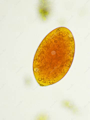 Egg of Intestinal Fluke in Human Stool Stock Image - Image of nematode ...