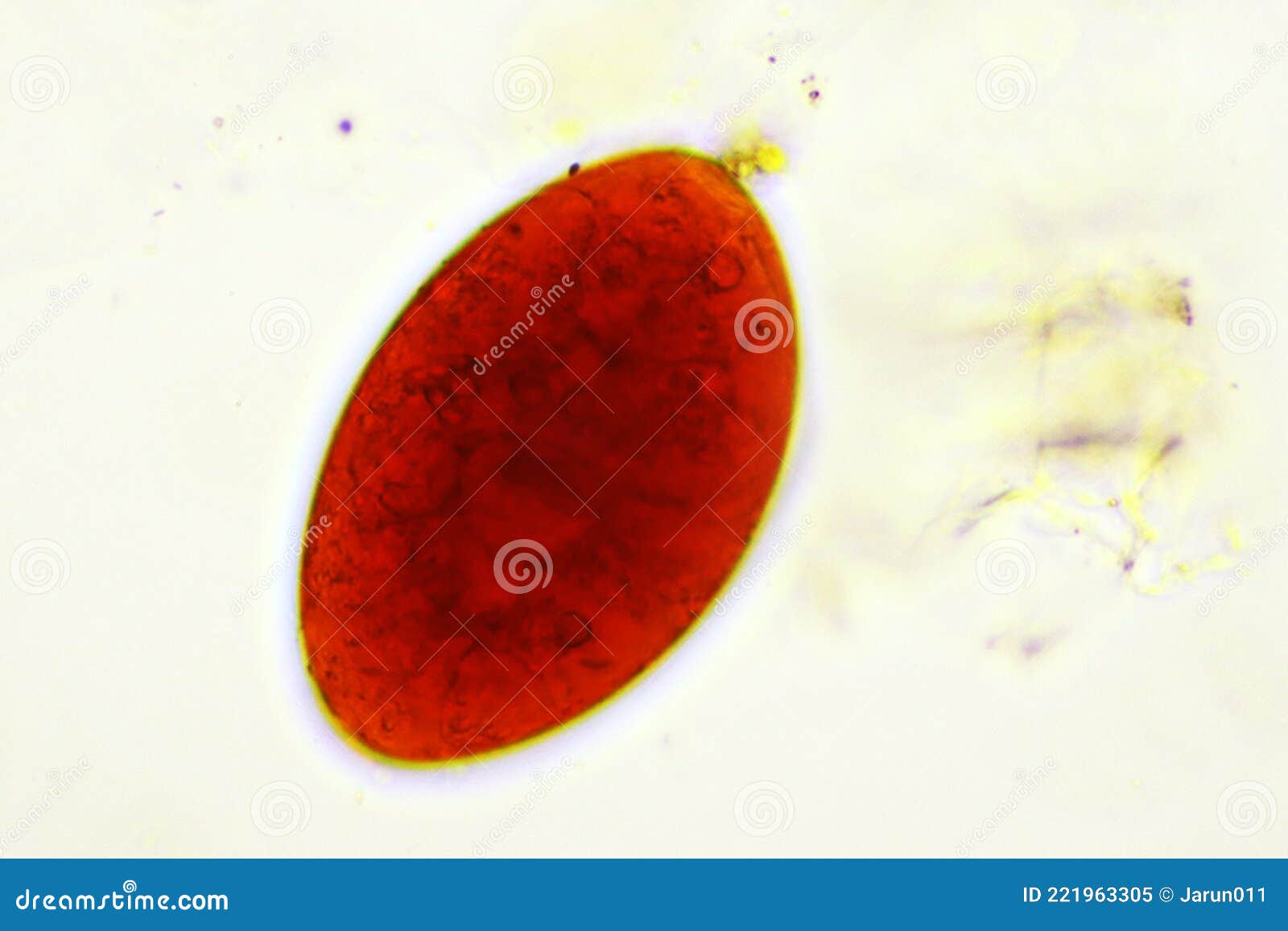 Egg of Intestinal Fluke in Human Stool Stock Image - Image of ...