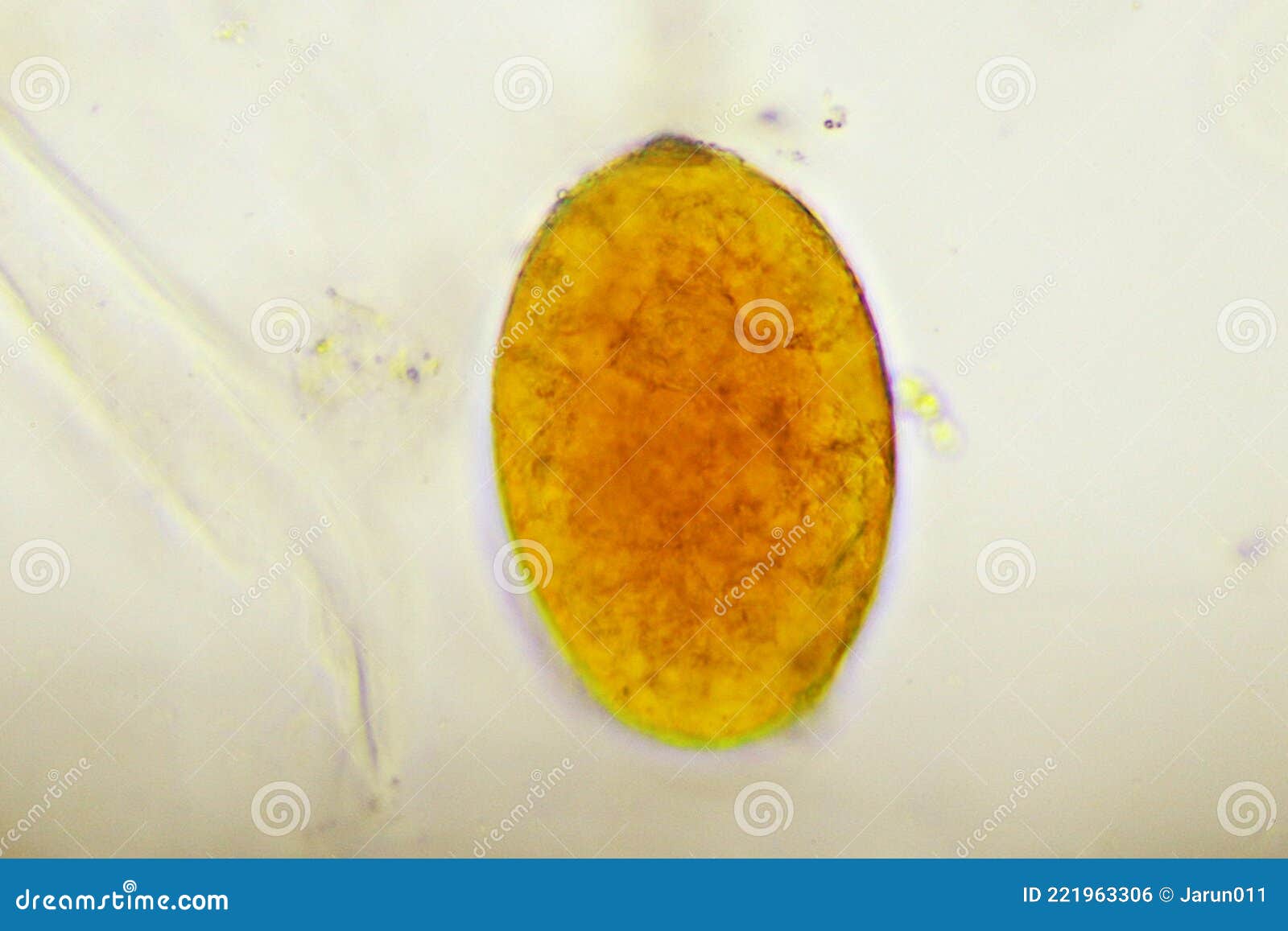 Egg of Intestinal Fluke in Human Stool Stock Photo - Image of human ...