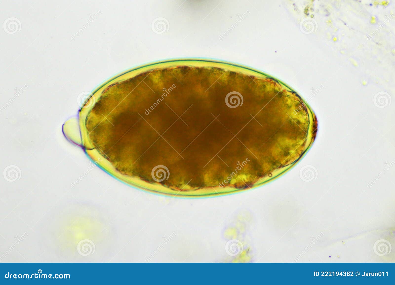 Egg of Intestinal Fluke in Human Stool Stock Photo - Image of ...