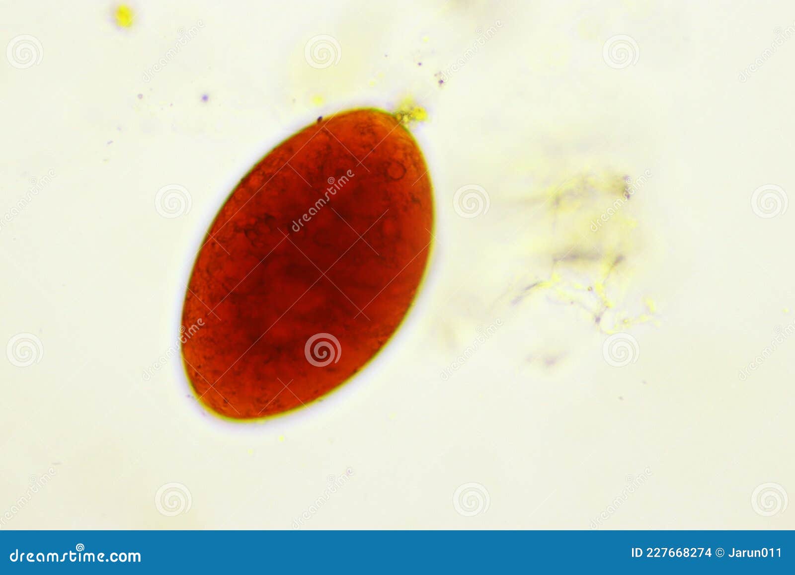 Egg of Intestinal Fluke in Human Stool Stock Photo - Image of ...