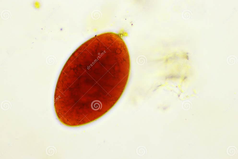 Egg of Intestinal Fluke in Human Stool Stock Photo - Image of ...
