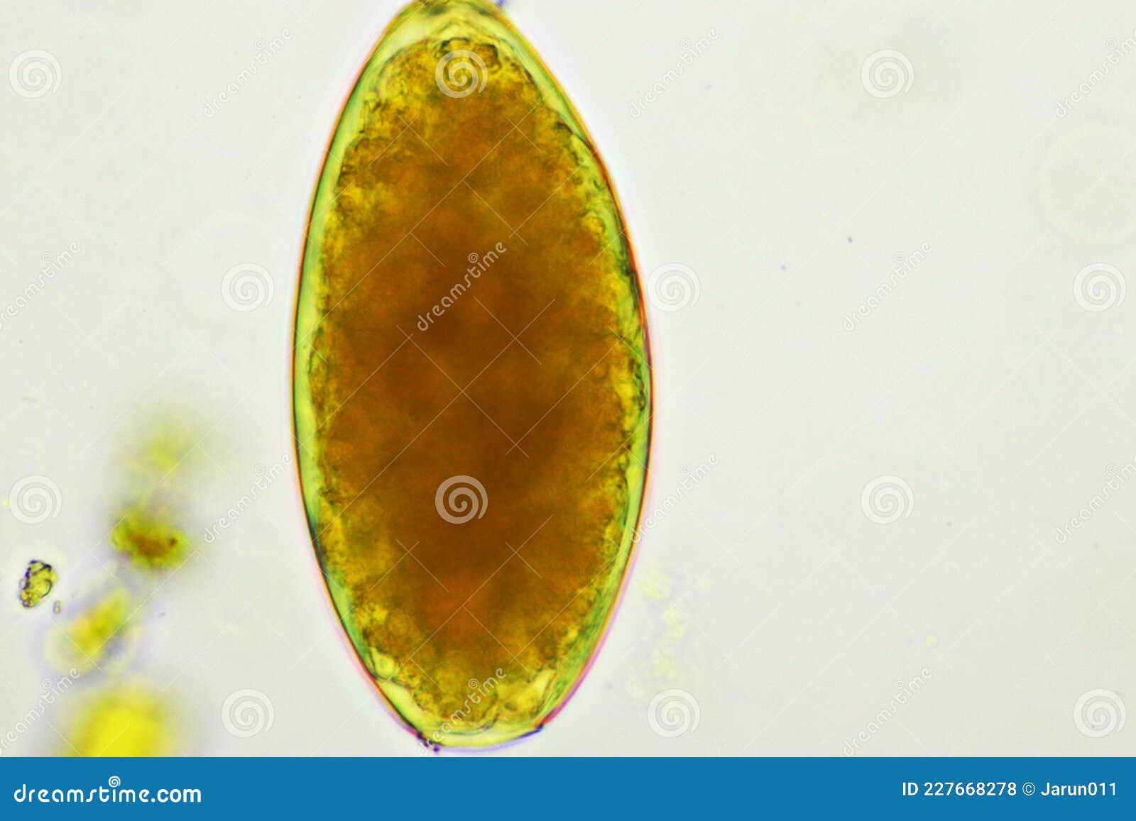 Egg of Intestinal Fluke in Human Stool Stock Photo - Image of fluke ...