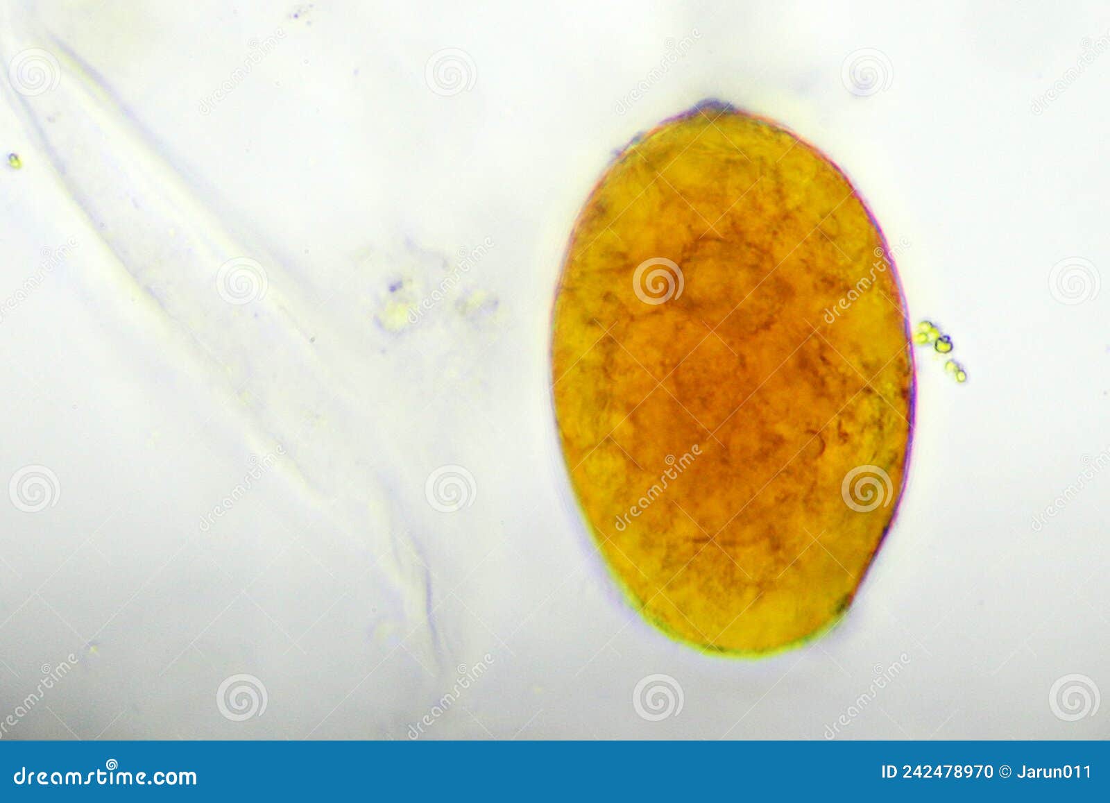 Egg of Intestinal Fluke in Human Stool Stock Photo - Image of nematode ...
