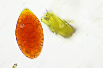 Egg of Intestinal Fluke in Human Stool Stock Photo - Image of ...