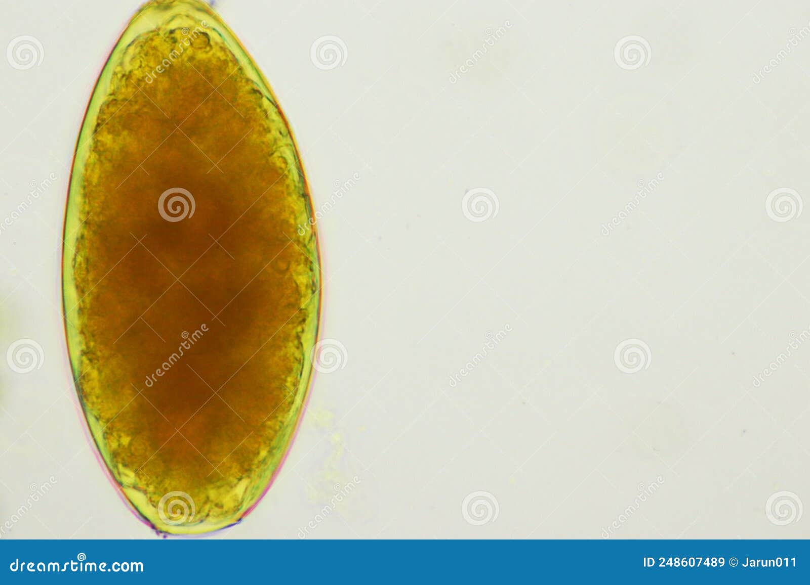 Egg of Intestinal Fluke in Human Stool Stock Image - Image of ...