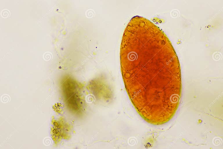 Egg of Intestinal Fluke in Human Stool Stock Image - Image of ascaris ...