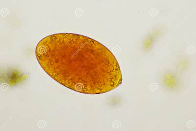 Egg of Intestinal Fluke in Human Stool Stock Photo - Image of analyzing ...