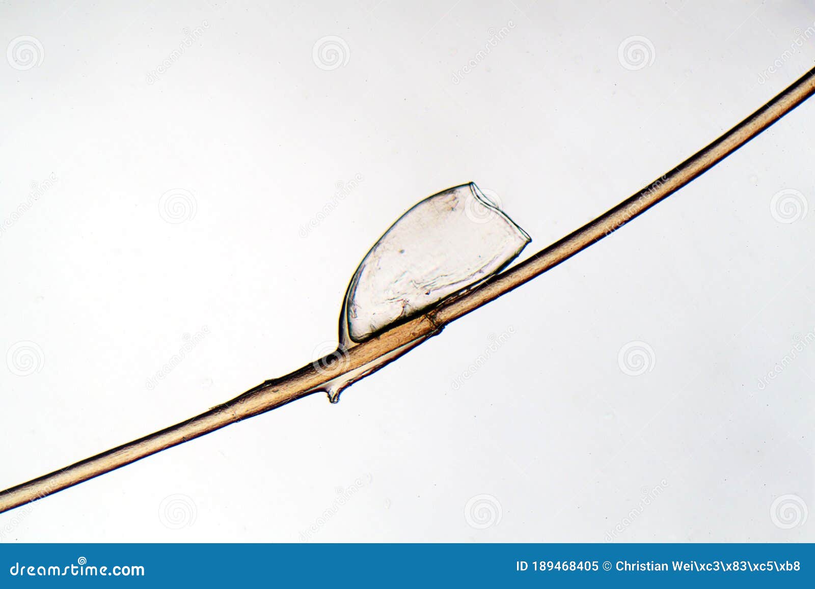 Egg or Nit of a Head Louse, Pediculus Humanus, on a Human Hair Stock ...