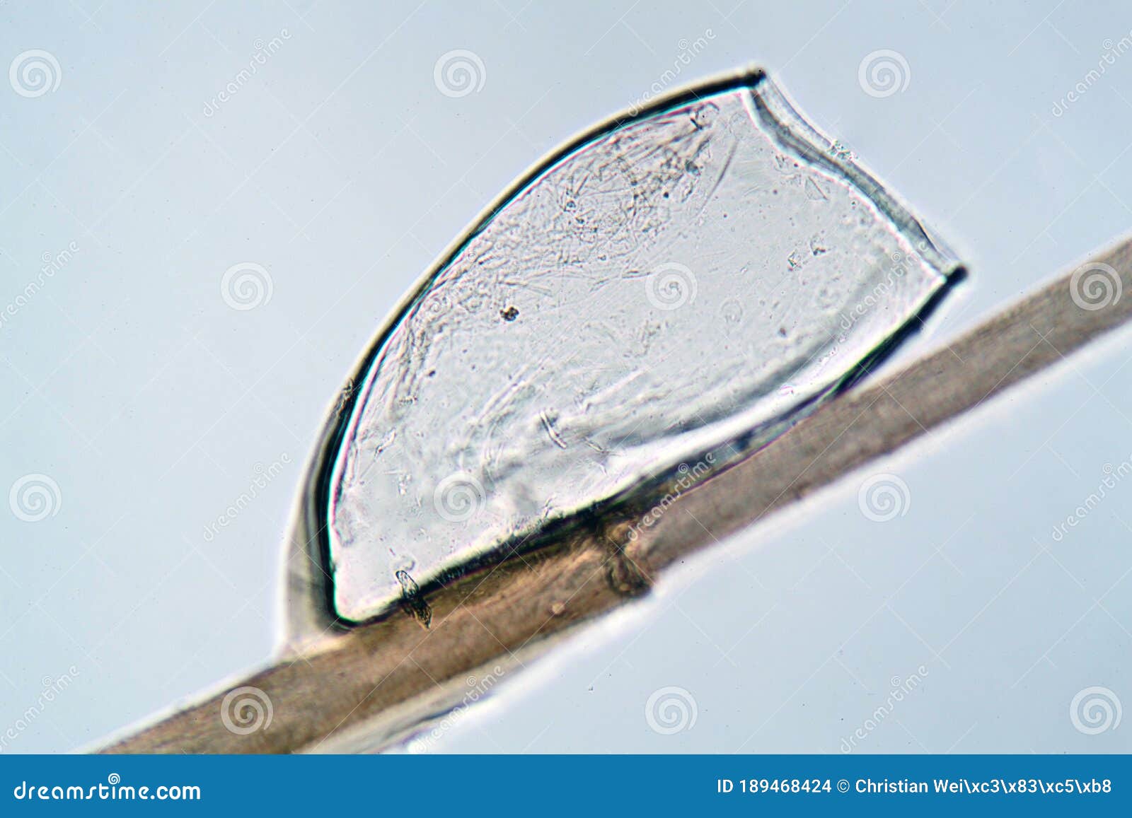 Egg or Nit of a Head Louse, Pediculus Humanus, on a Human Hair Stock ...