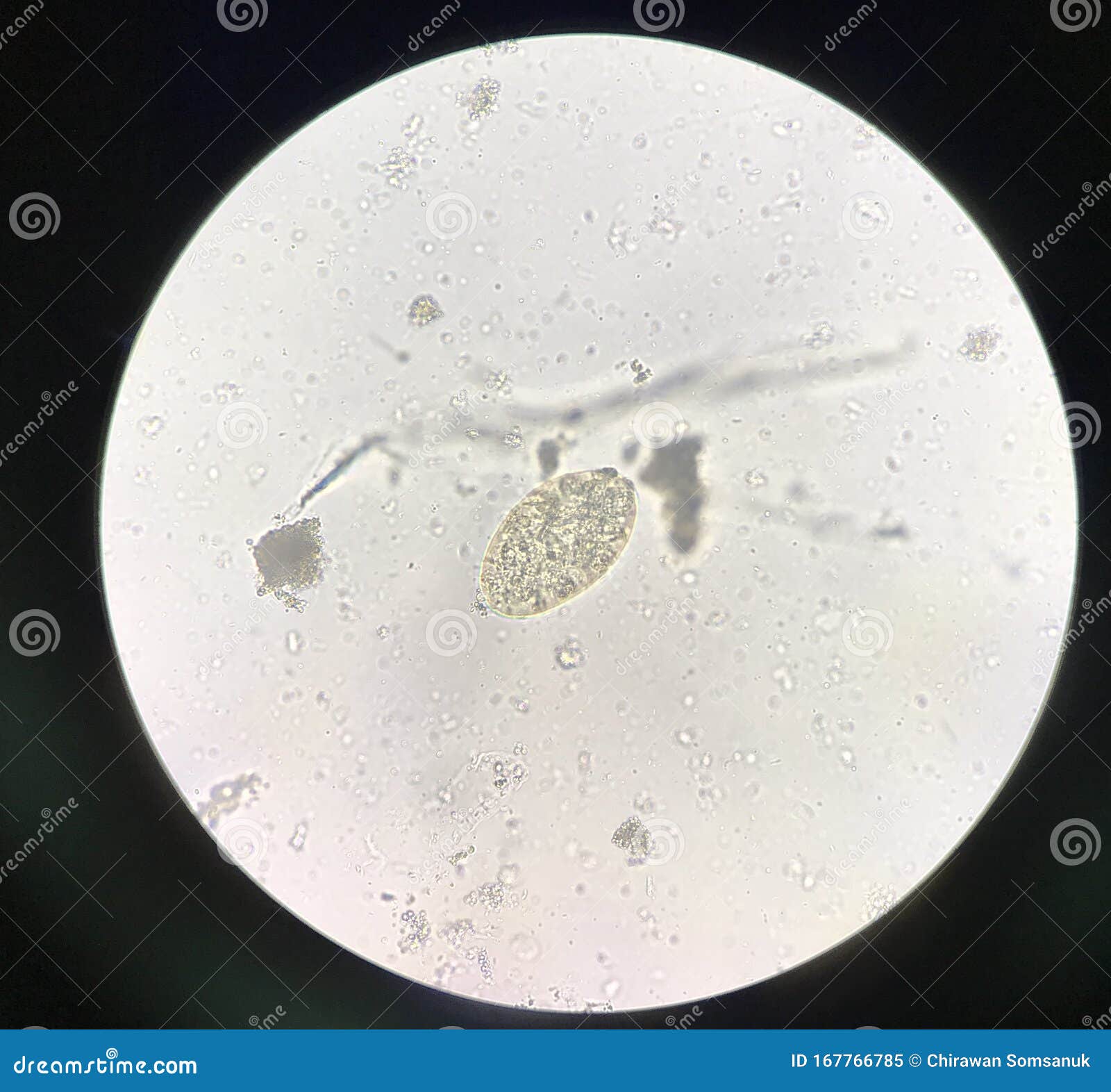 Parasite Human Stool
