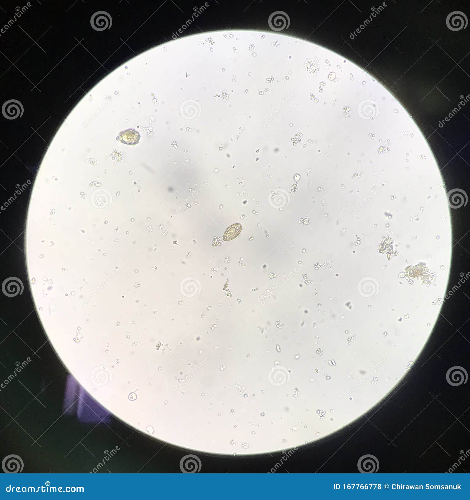 Egg Parasite Human in Stool Examination Stock Photo - Image of ...