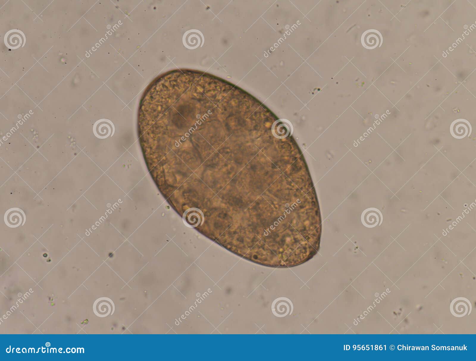 Egg of parasite in stool stock image. Image of parasite - 95651861