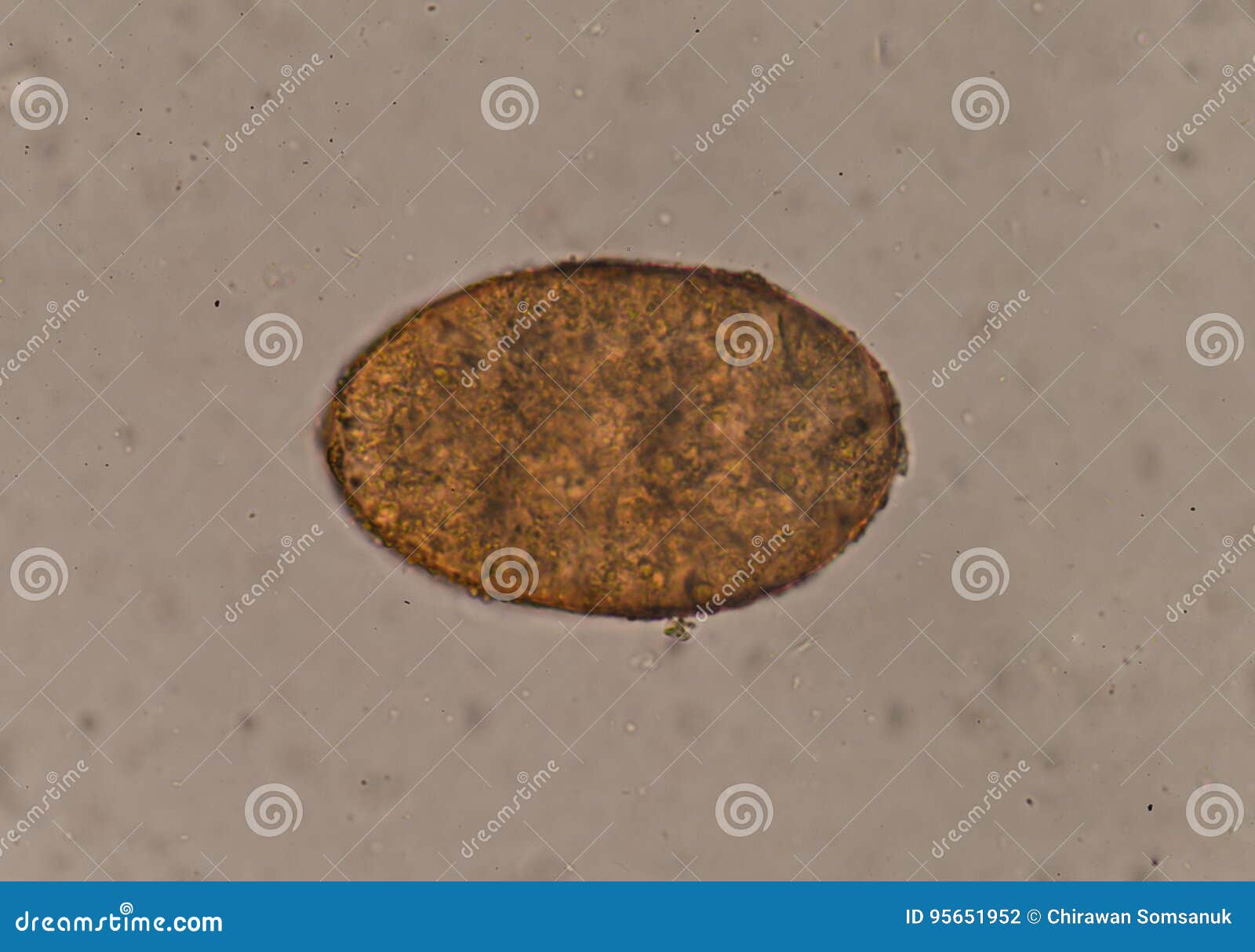Egg of parasite in stool stock photo. Image of liver - 95651952