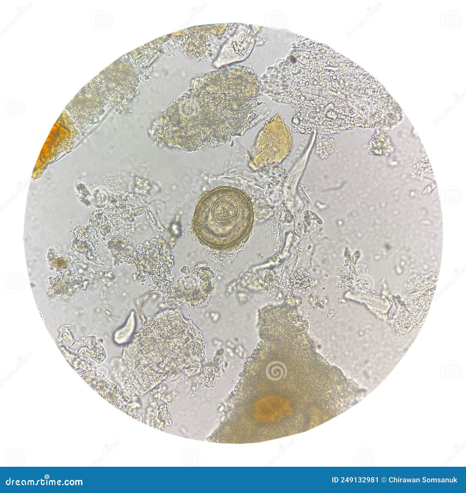 Egg of Parasite in Stool Exam Stock Image - Image of disease, anatomy ...