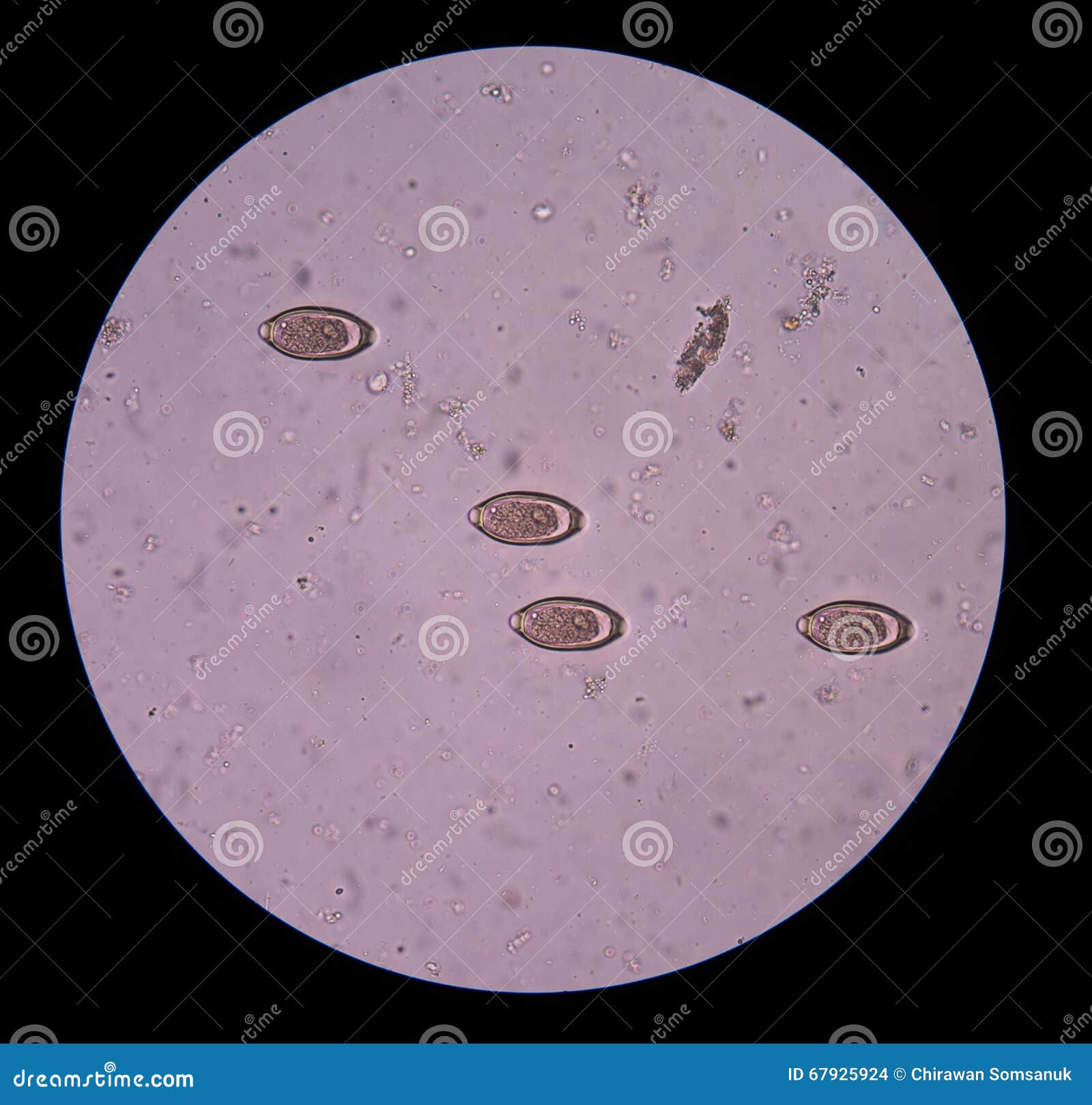 Parasite In Stool Sample