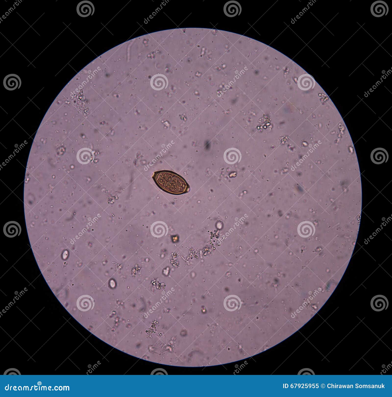 Egg parasite. stock image. Image of microscopic, nematode - 67925955