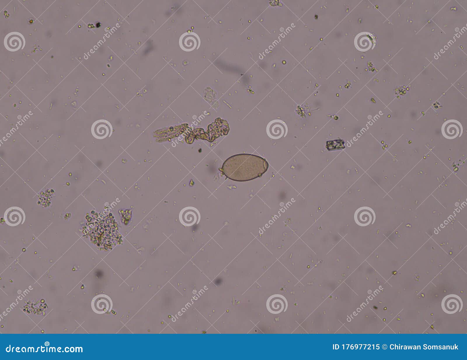 Egg of Parasite in Stool Examition Testing Stock Image - Image of cell ...