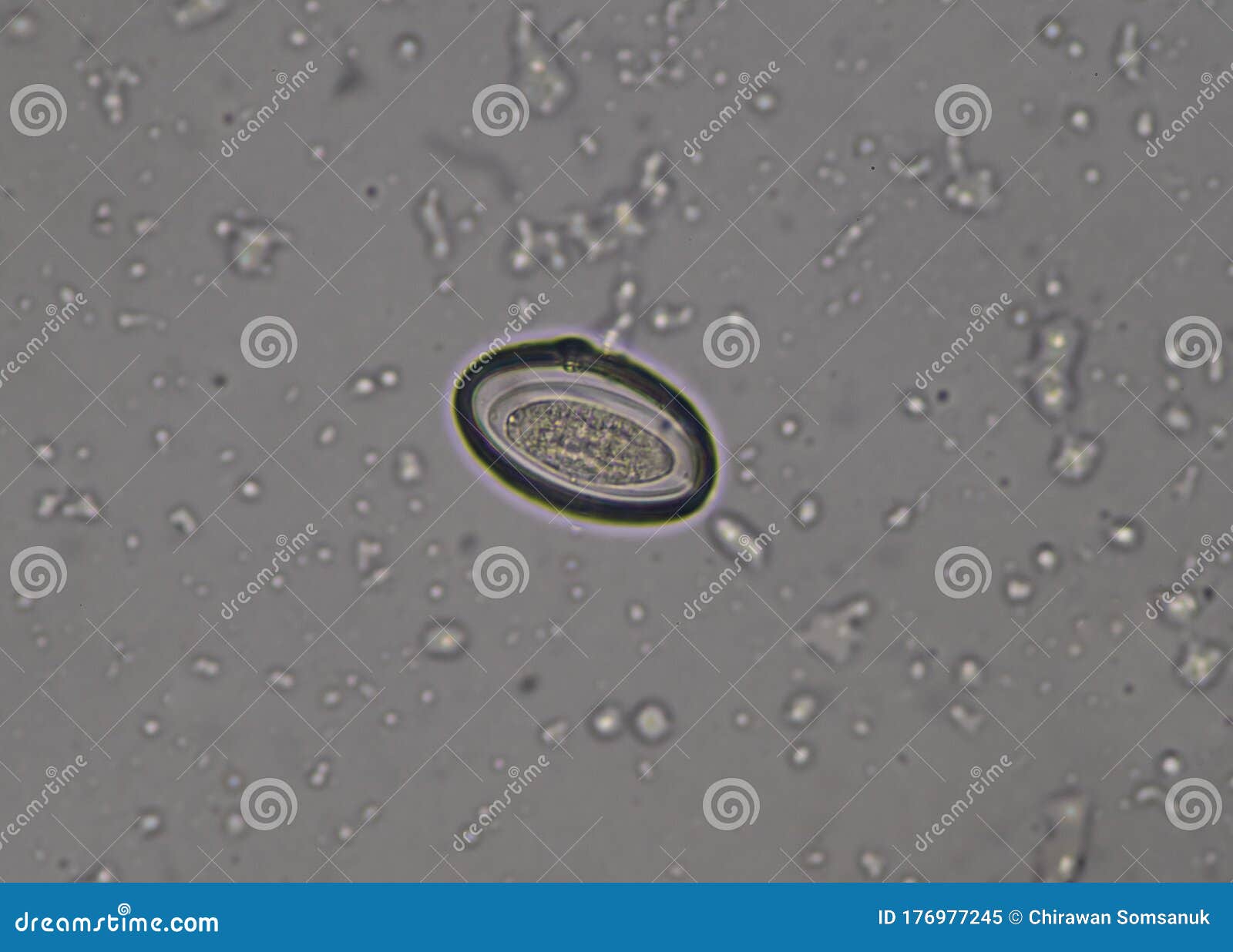 Egg of Parasite in Stool Examition Testing Stock Image - Image of ...