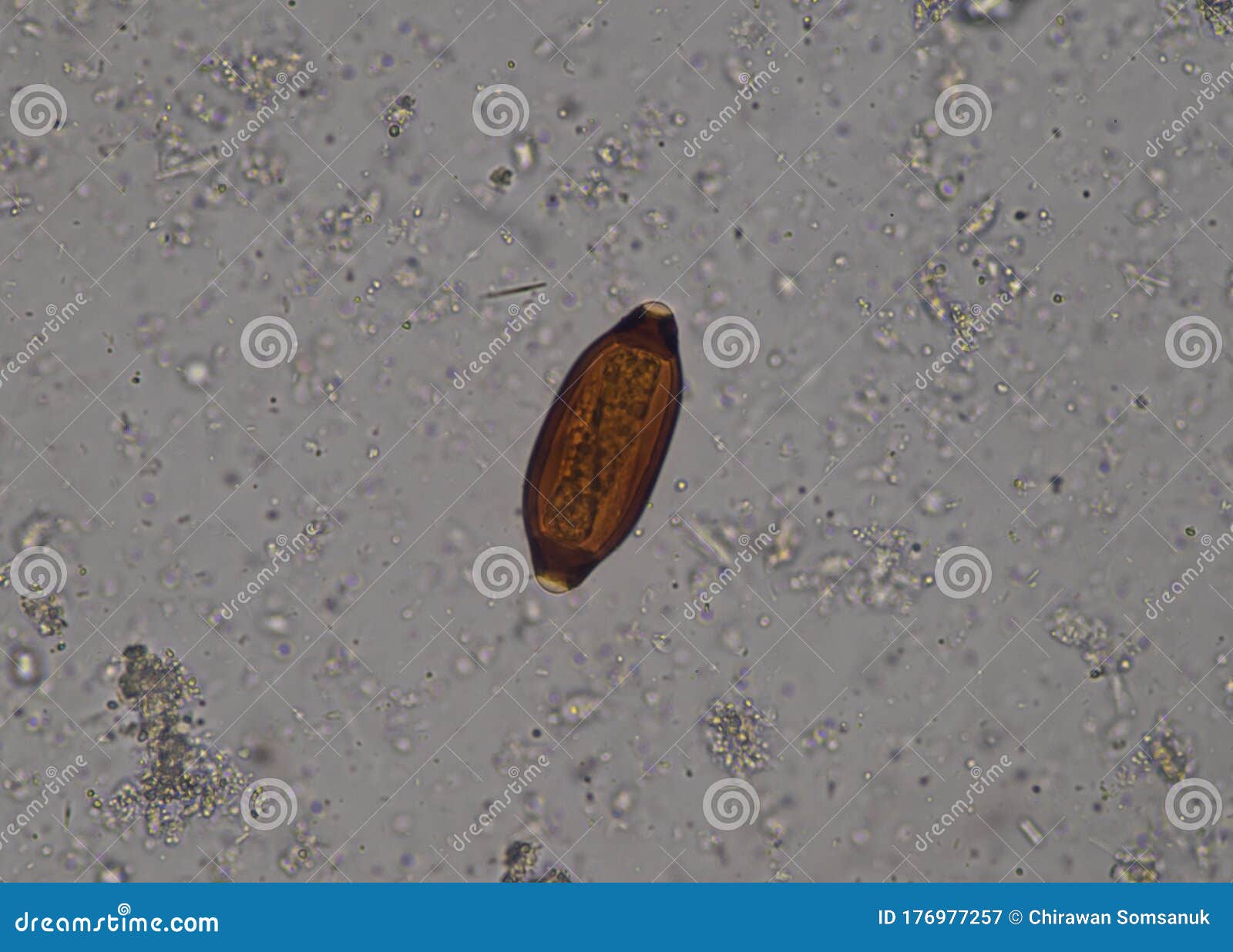 Egg of Parasite in Stool Examition Testing Stock Image - Image of ...