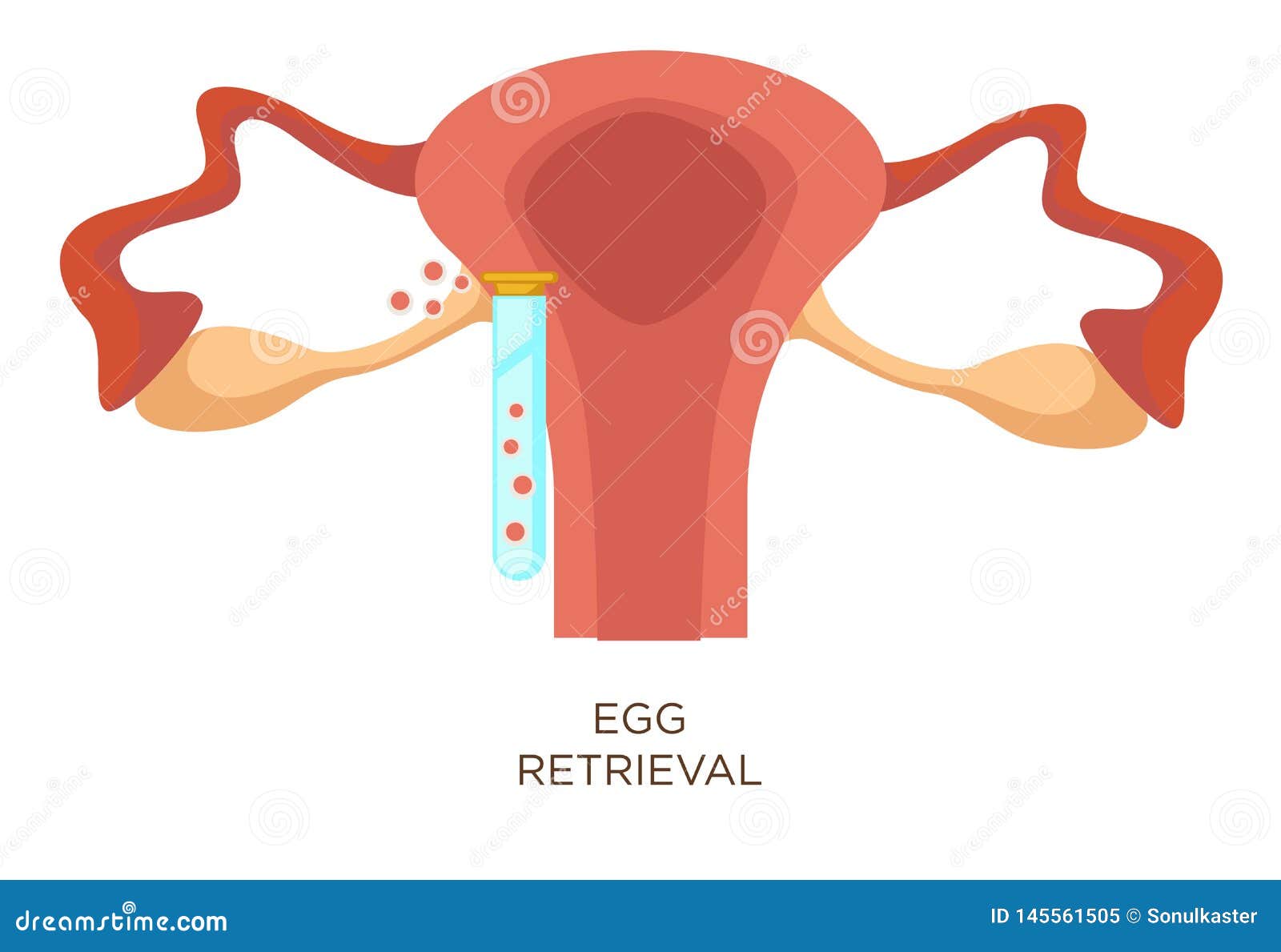 Egg Retrieval Stage in Vitro Fertilization Artificial Insemination ... Egg Retrieval Stage in Vitro Fertilization Artificial Insemination ...