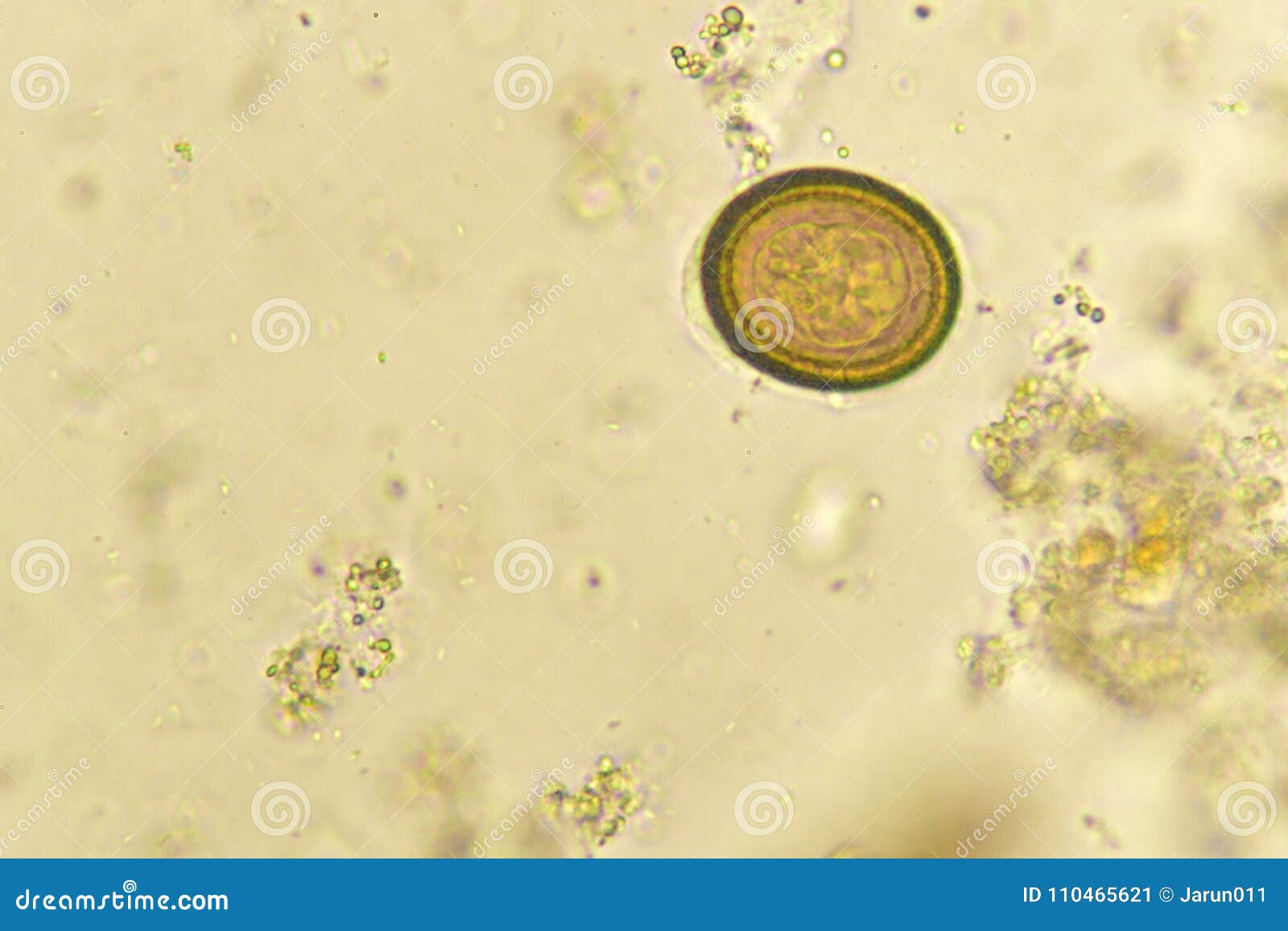 Egg of Taenia in stool stock image. Image of roundworm - 110465621