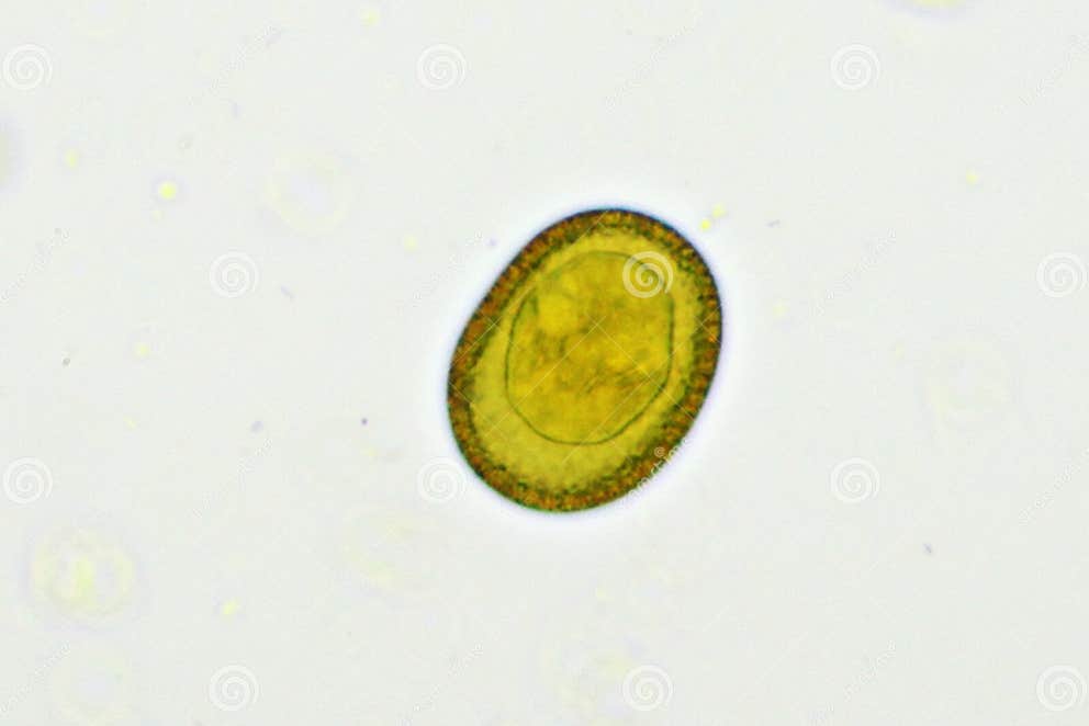 Egg of Taenia or Tapeworm in Human Stool Stock Image - Image of analyze ...