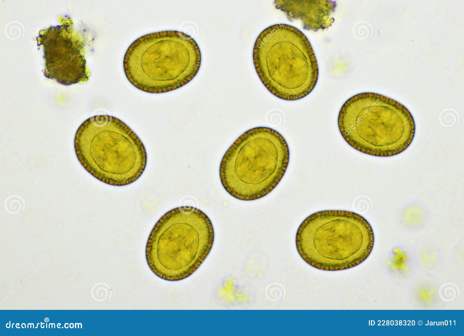 Egg of Taenia or Tapeworm in Human Stool Stock Photo - Image of 400x ...