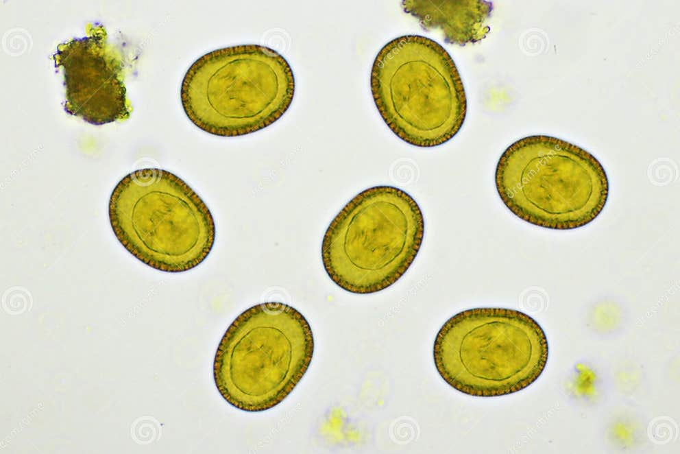 Egg of Taenia or Tapeworm in Human Stool Stock Photo - Image of 400x ...